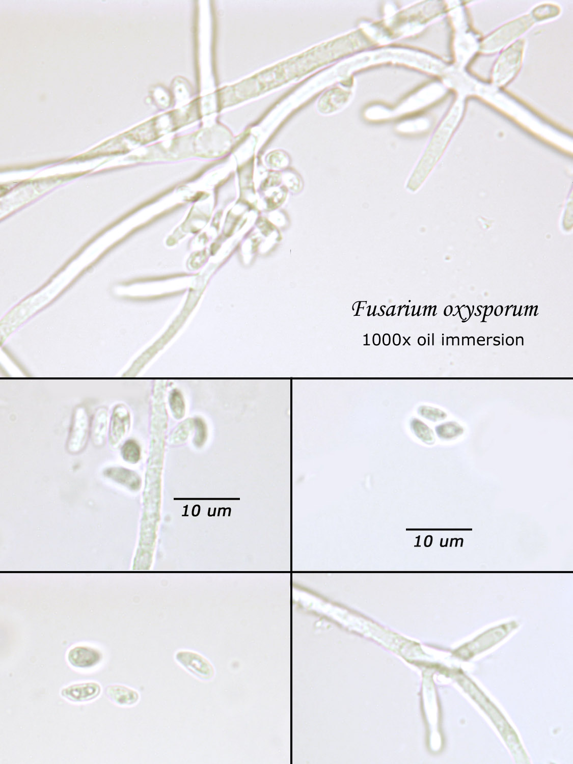 Fusarium Spores